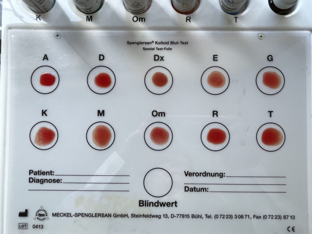 Spenglersan-Kolloid-Blut-Test – Karin Löprich
