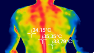 Thermographie mit Meditherm – Karin Löprich
